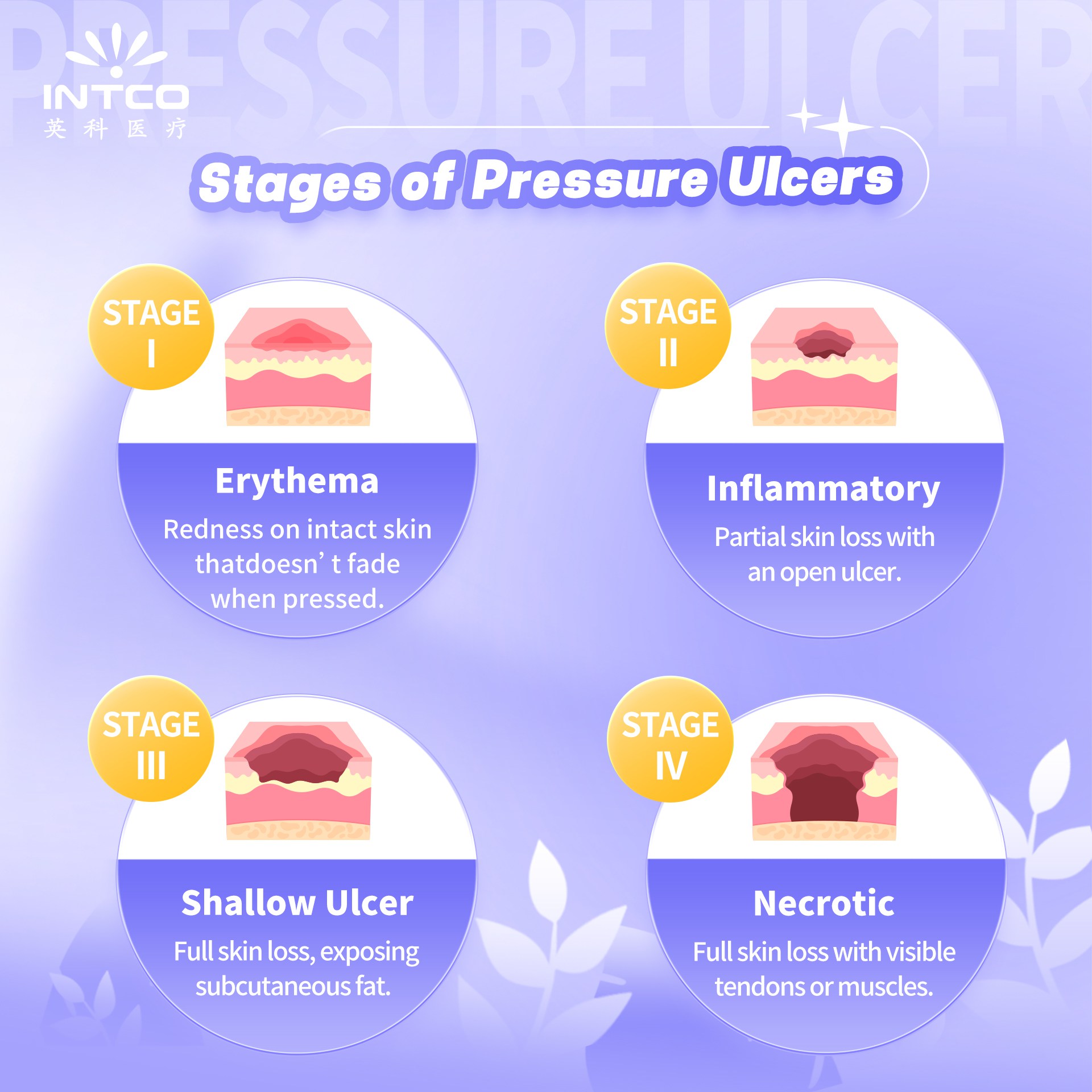 Effective Pressure Ulcer Care for Wheelchair Users